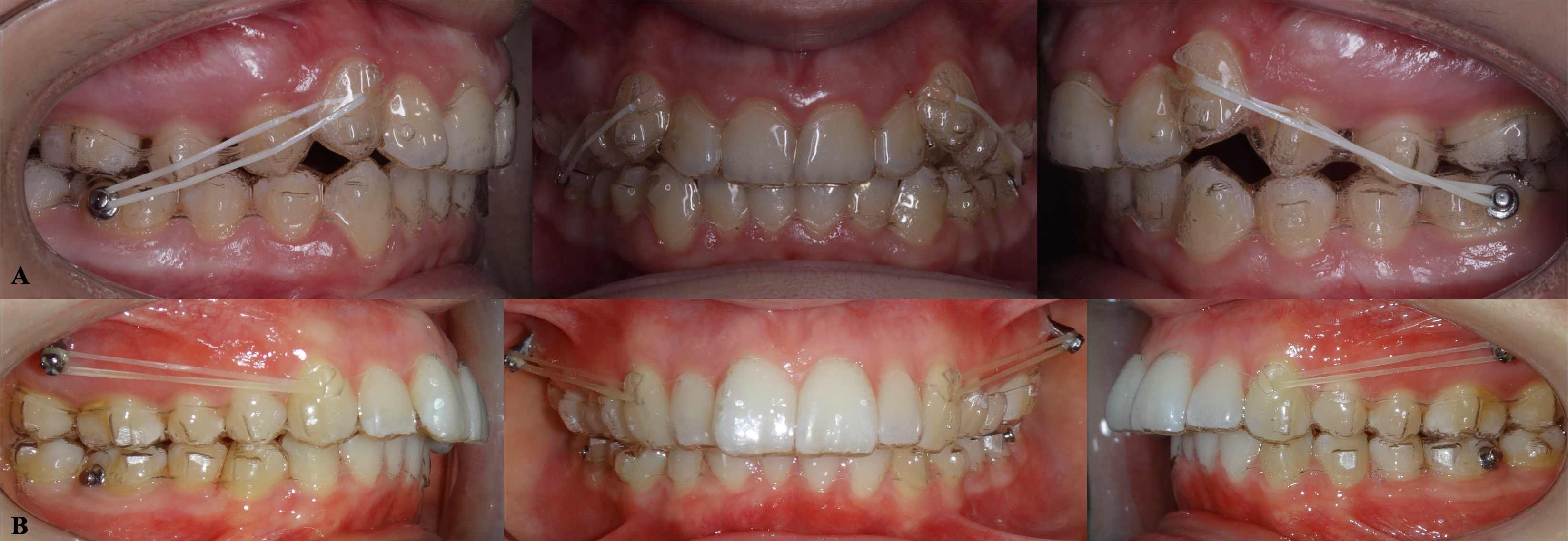 Journal of Clinical Pediatric Dentistry (JOCPD)