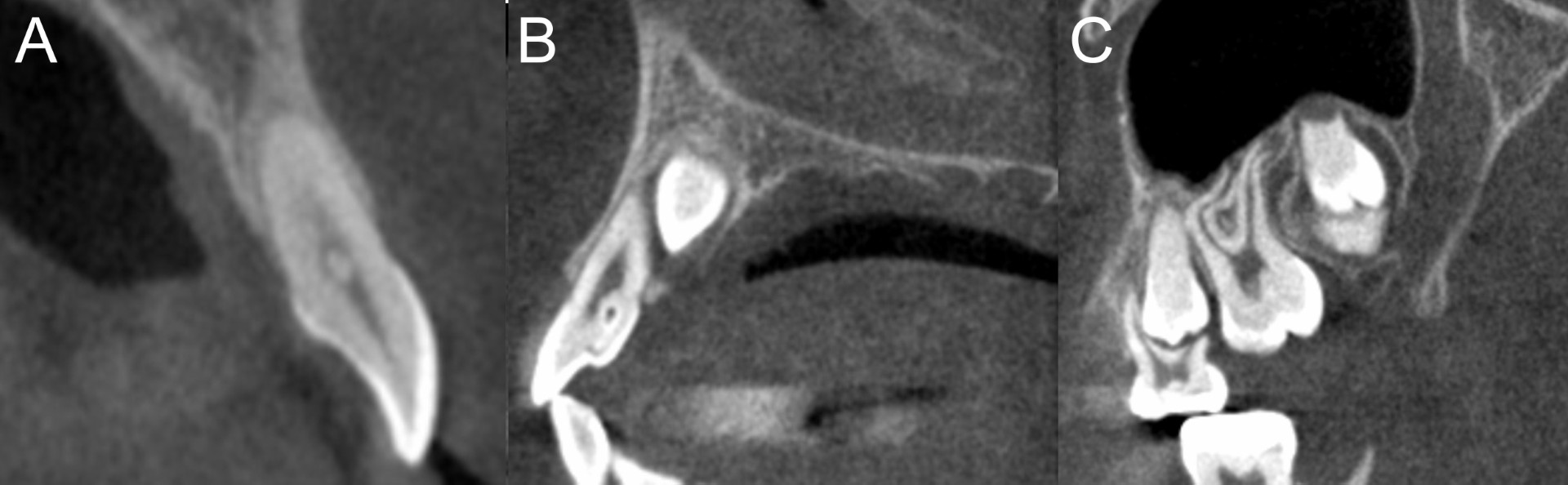 Journal of Clinical Pediatric Dentistry (JOCPD)