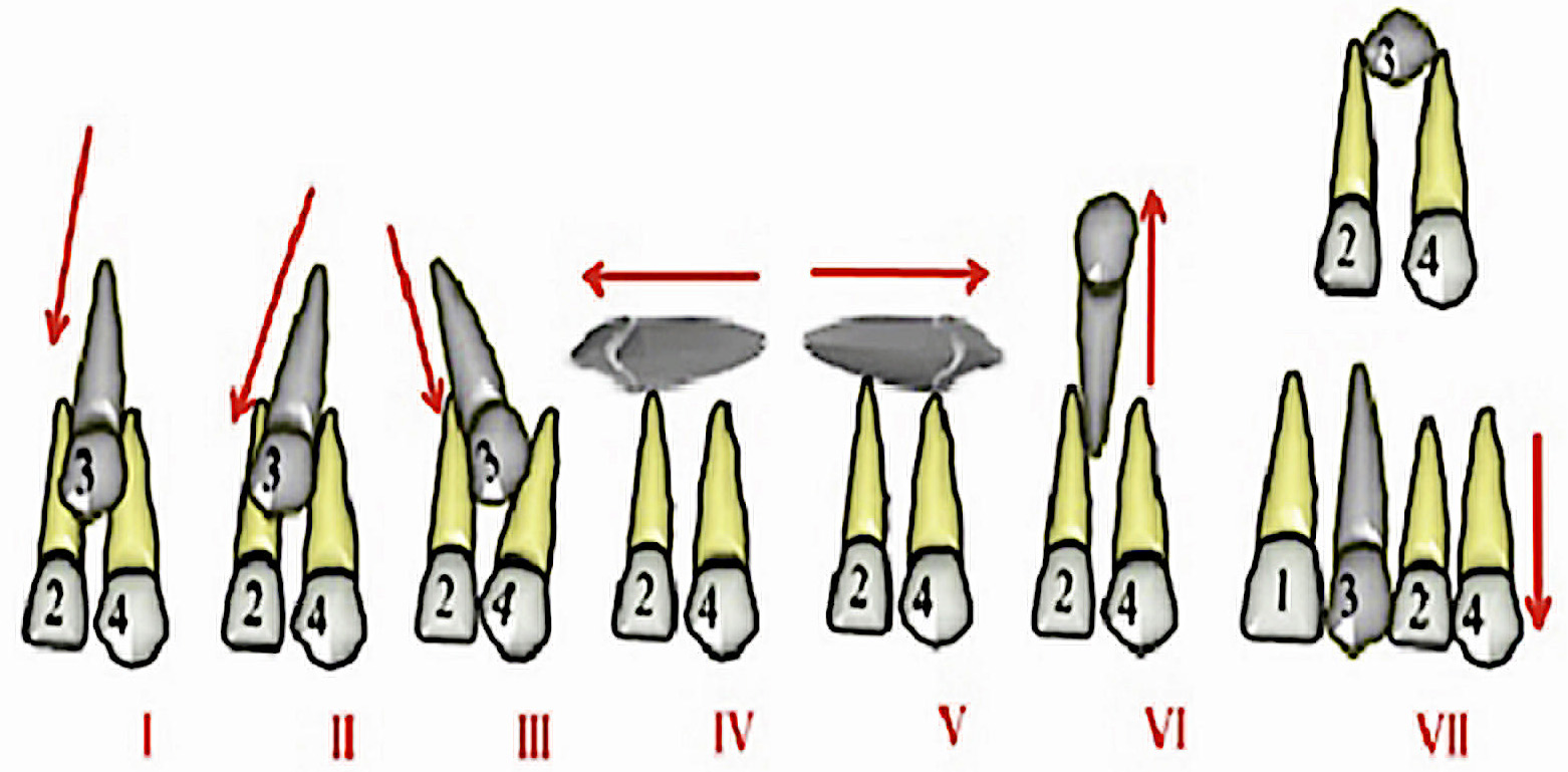 Journal of Clinical Pediatric Dentistry (JOCPD)